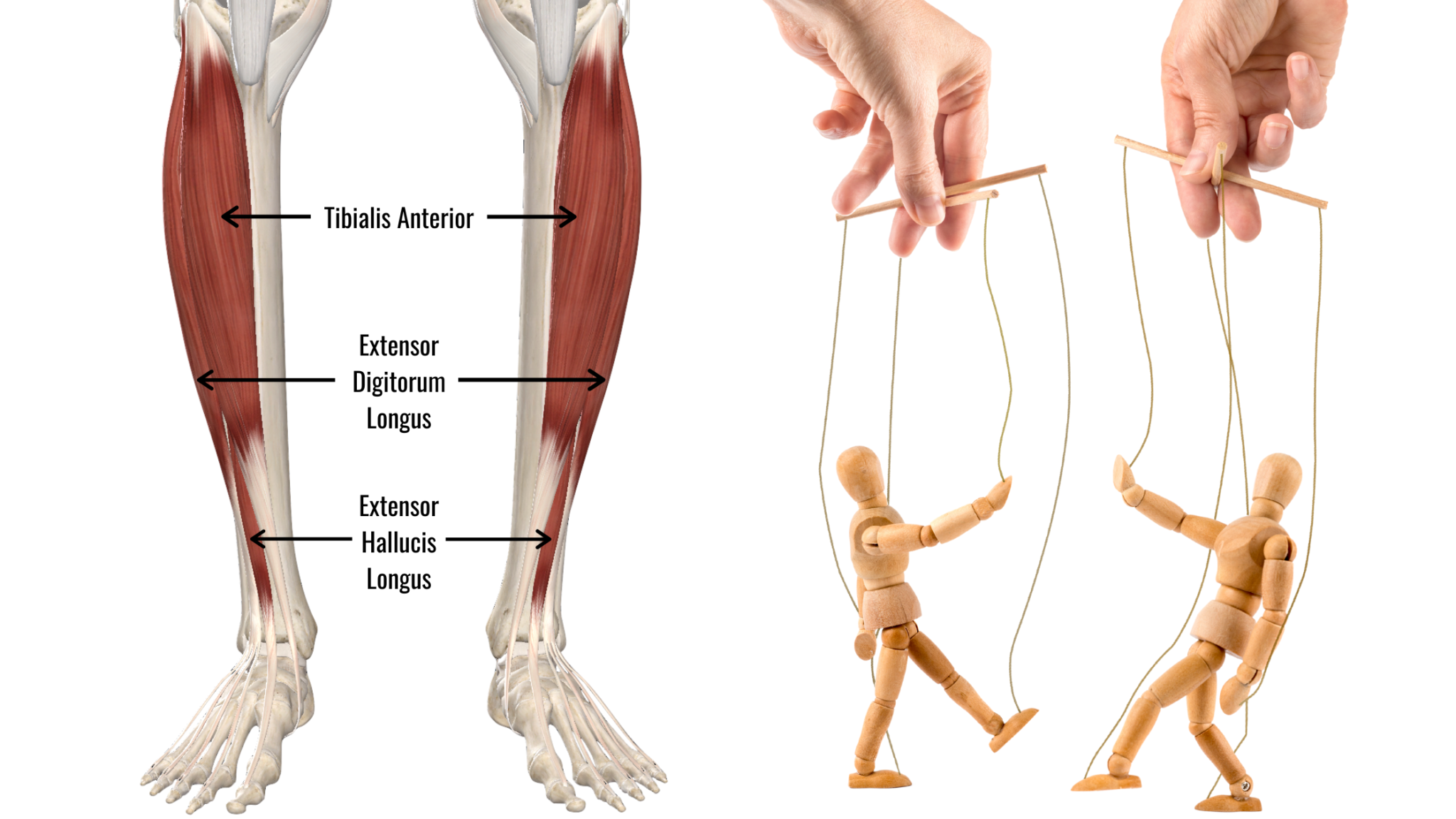 The Marionette – The Anterior Leg Compartment - Move Better Health ...